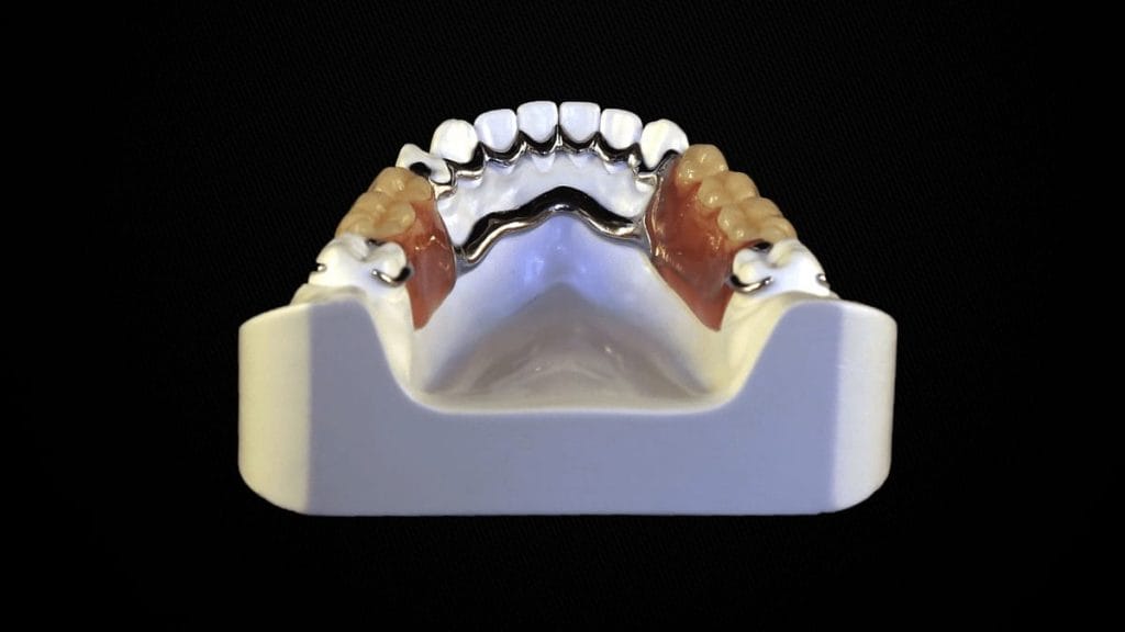 Stellite Valplast - Mon Prothésiste