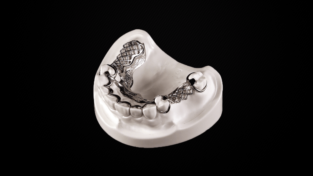 Prothèses dentaires - Mon Prothésiste